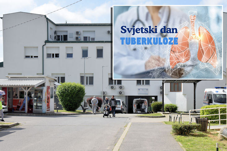 Tuberkuloza je i dalje dio naše stvarnosti - TV Nasice.com